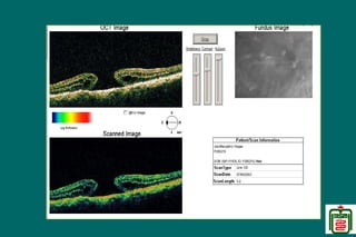 Optical Coherence Tomography (OCT) | PPT