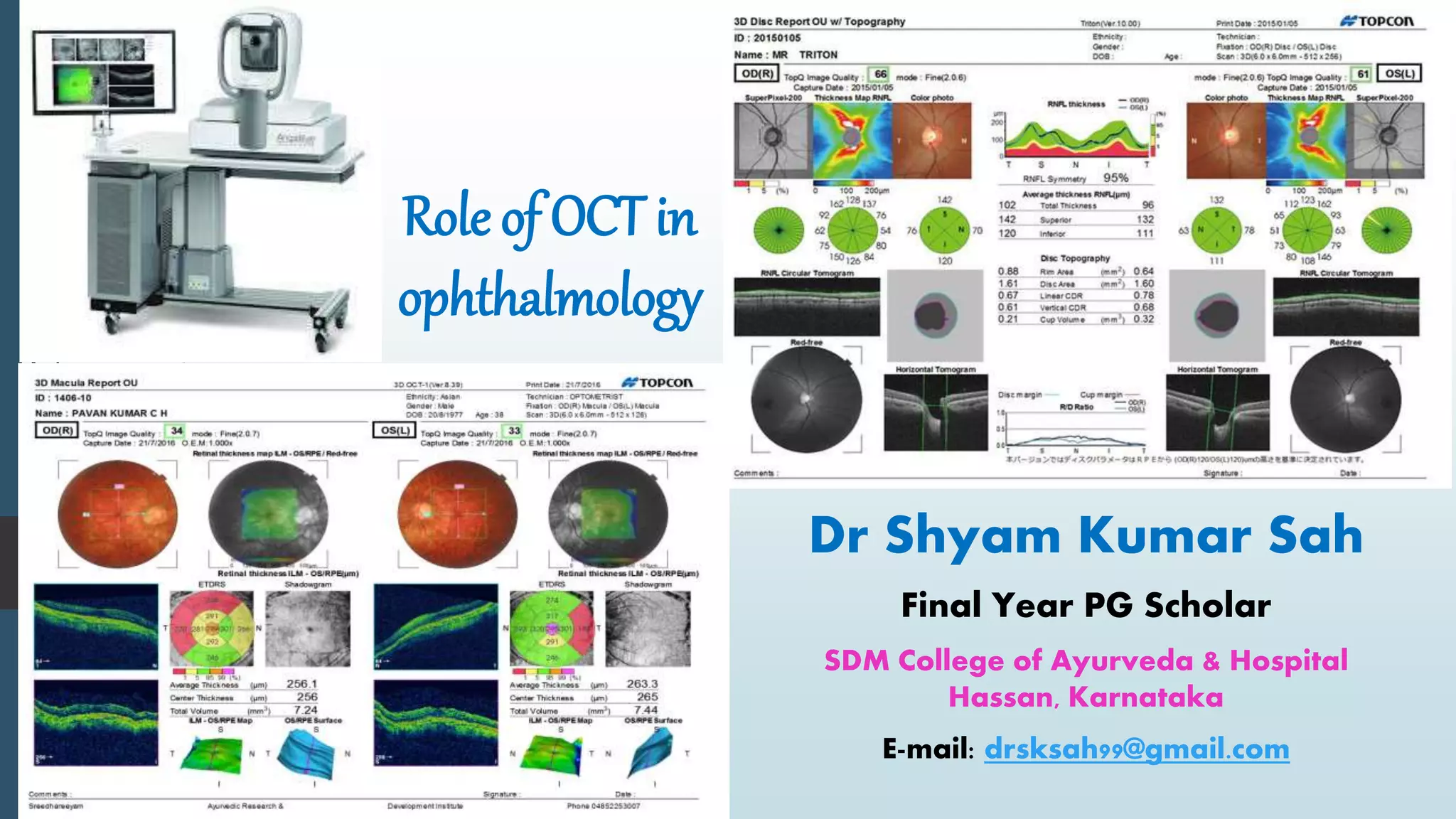 Role of oct in ophthalmology | PPTX