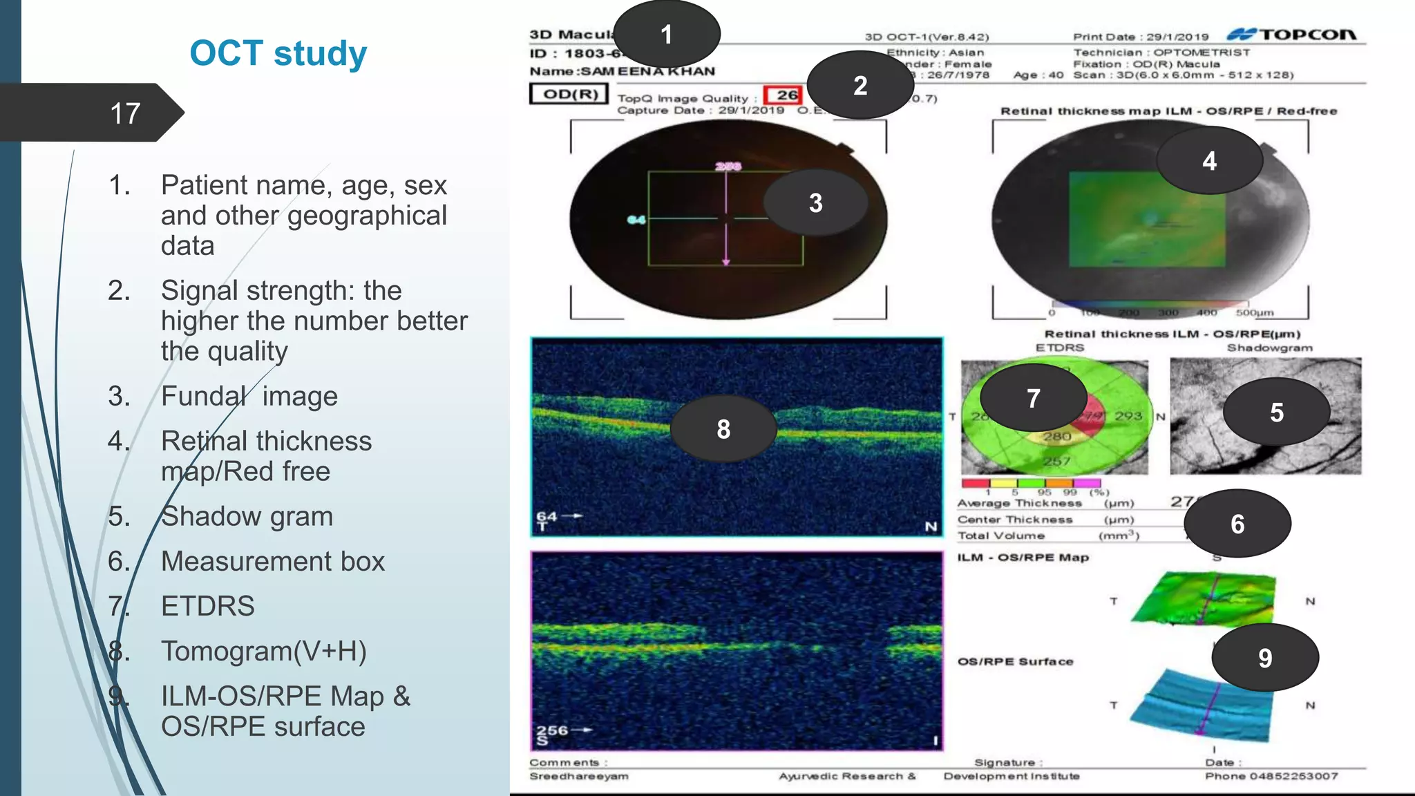 Role of oct in ophthalmology | PPTX