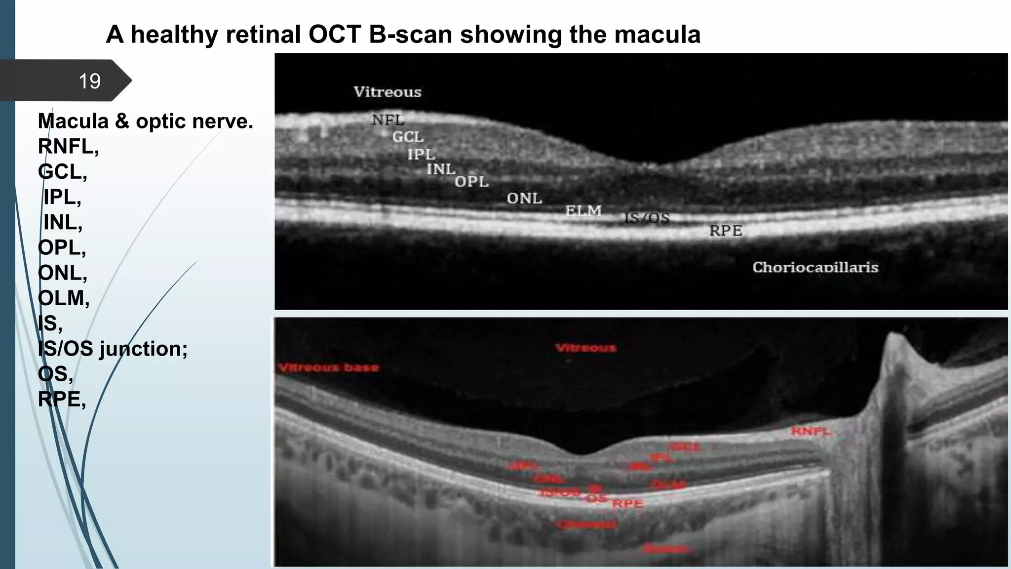 Role of oct in ophthalmology | PPTX