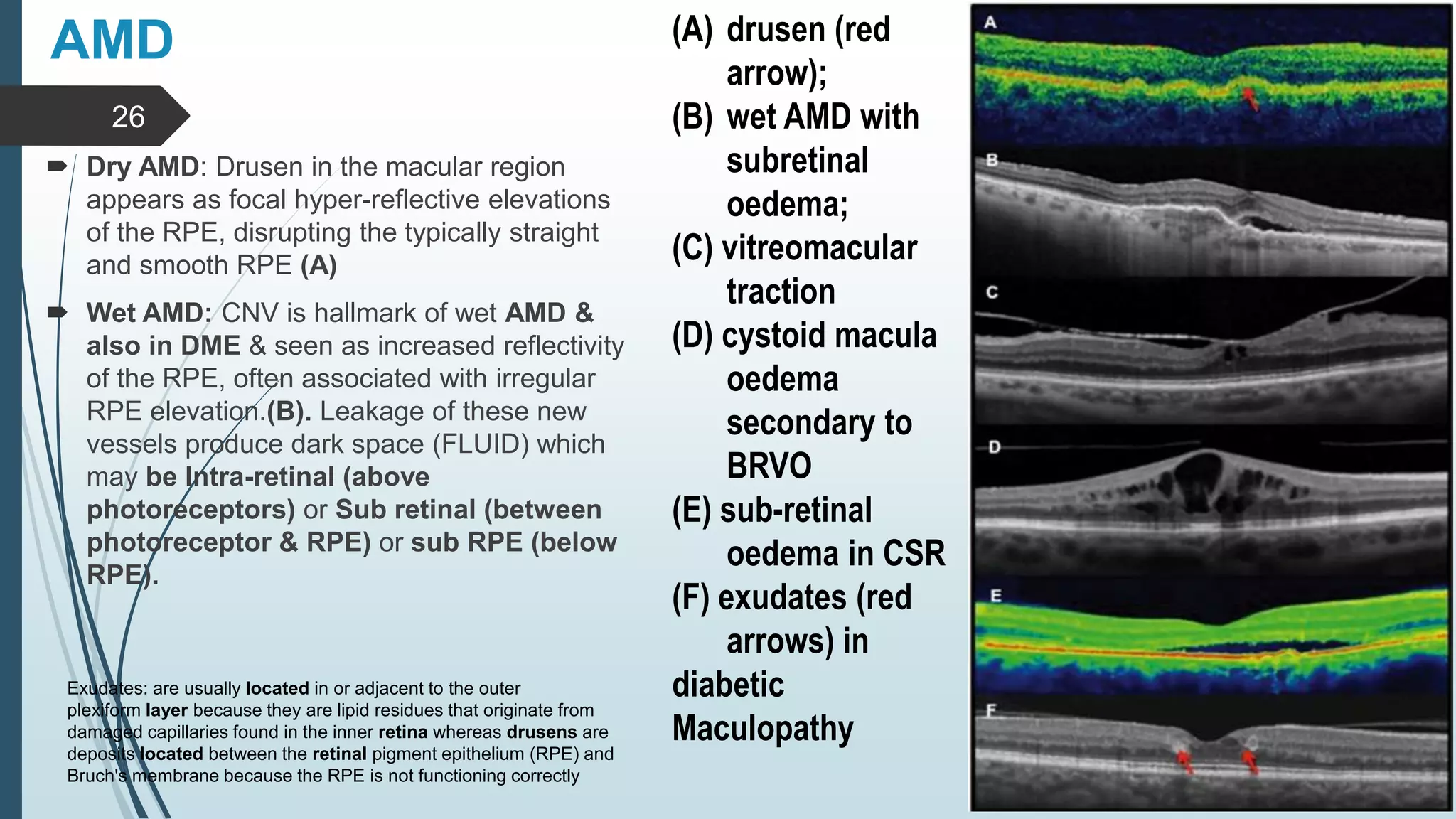 Role of oct in ophthalmology | PPTX