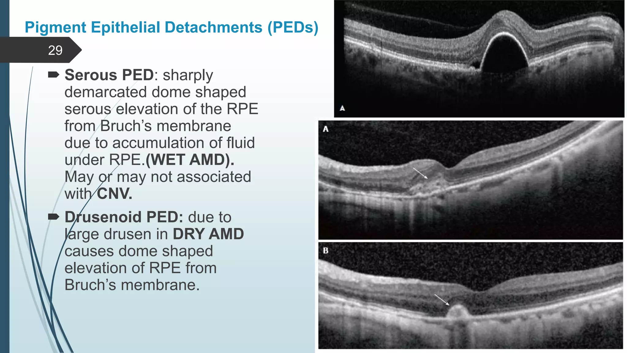 Role of oct in ophthalmology | PPTX