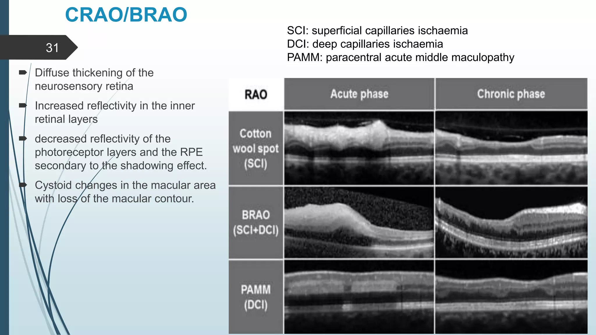 Role of oct in ophthalmology | PPTX