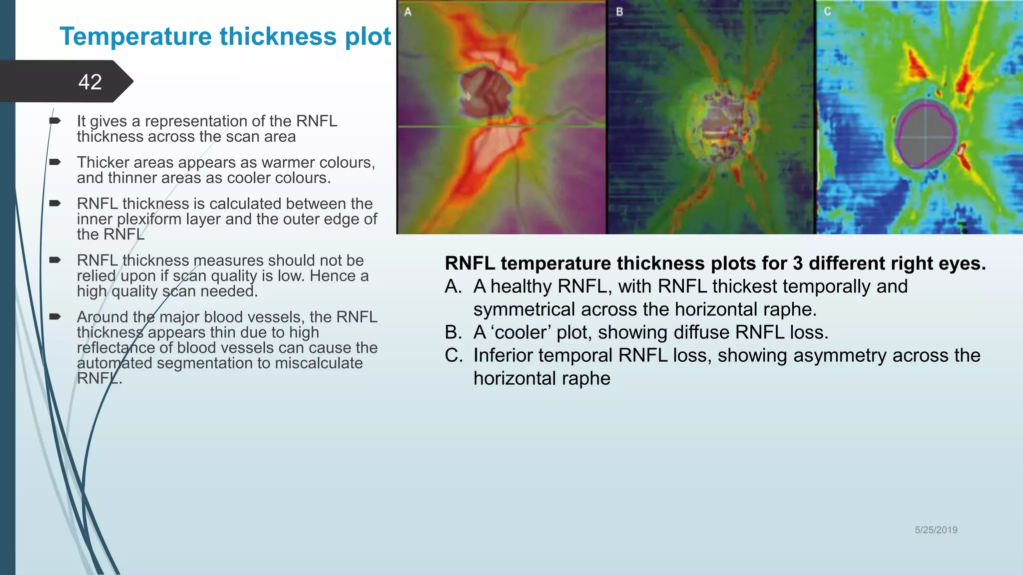 Role of oct in ophthalmology | PPTX