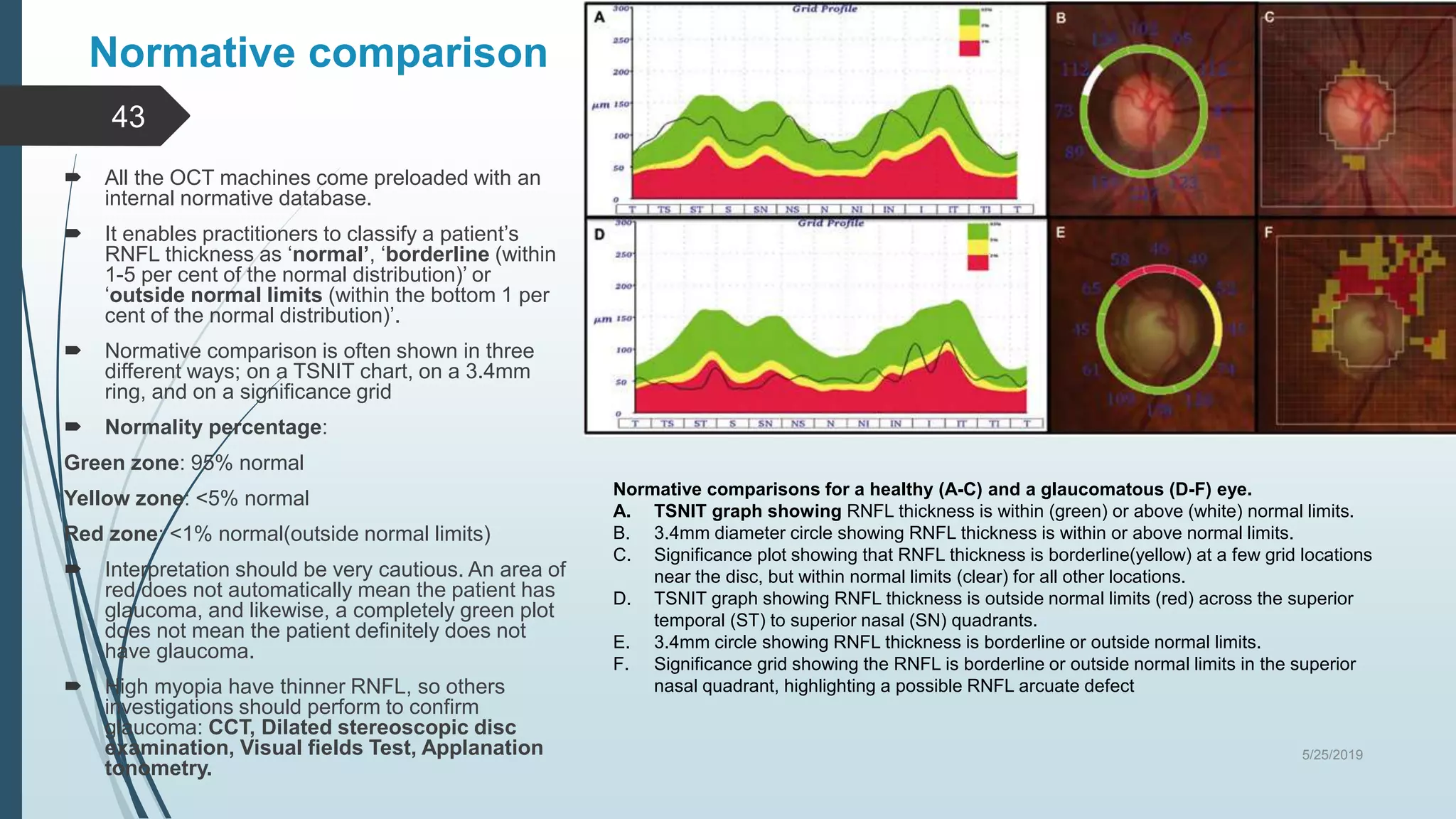 Role of oct in ophthalmology | PPTX