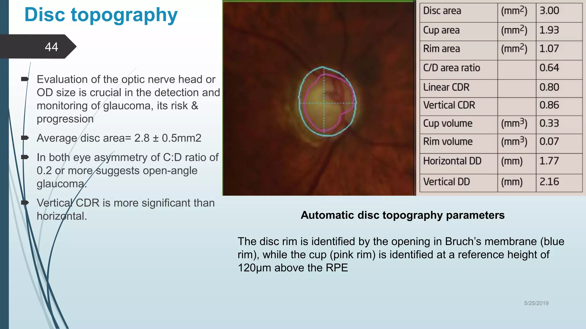 Role of oct in ophthalmology | PPTX