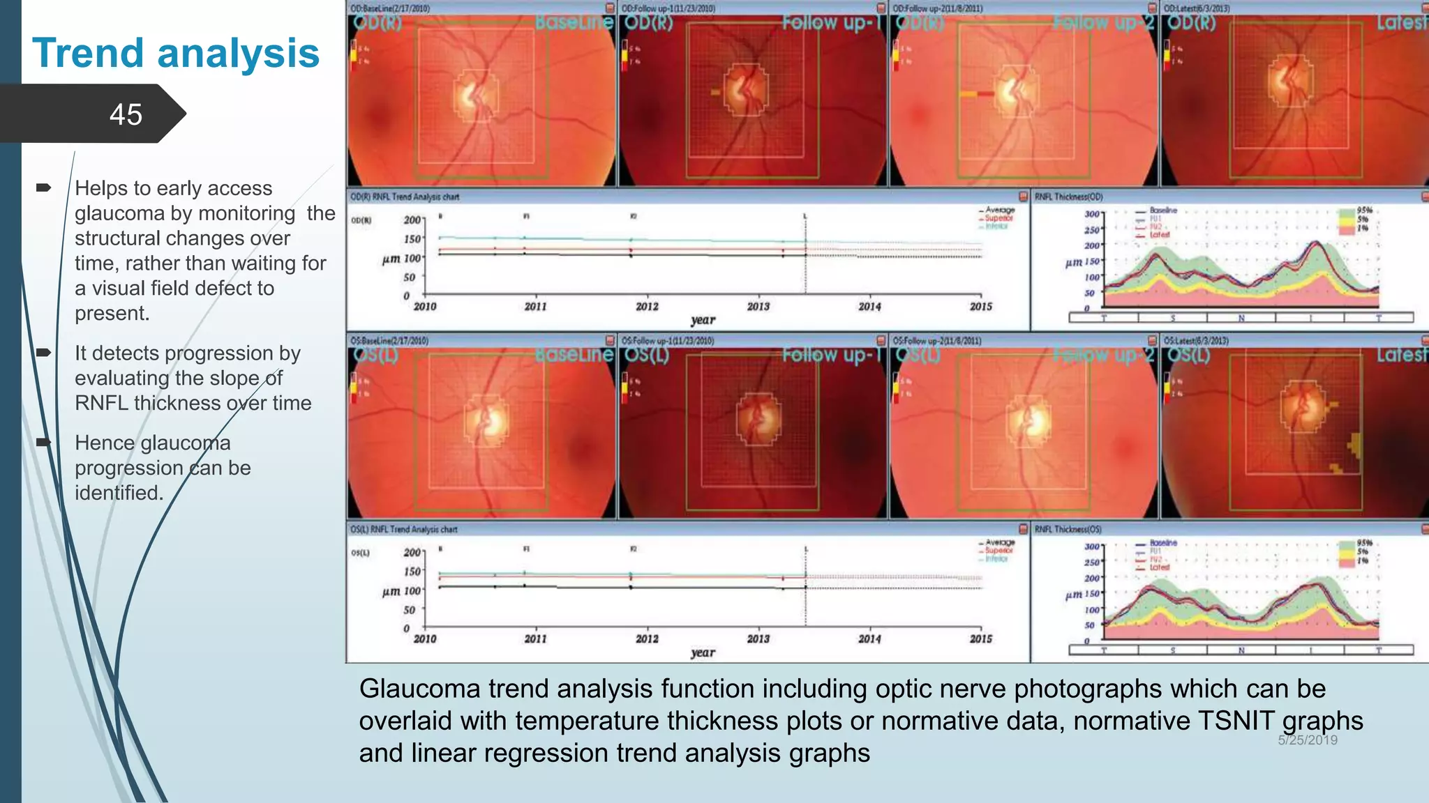 Role of oct in ophthalmology | PPTX