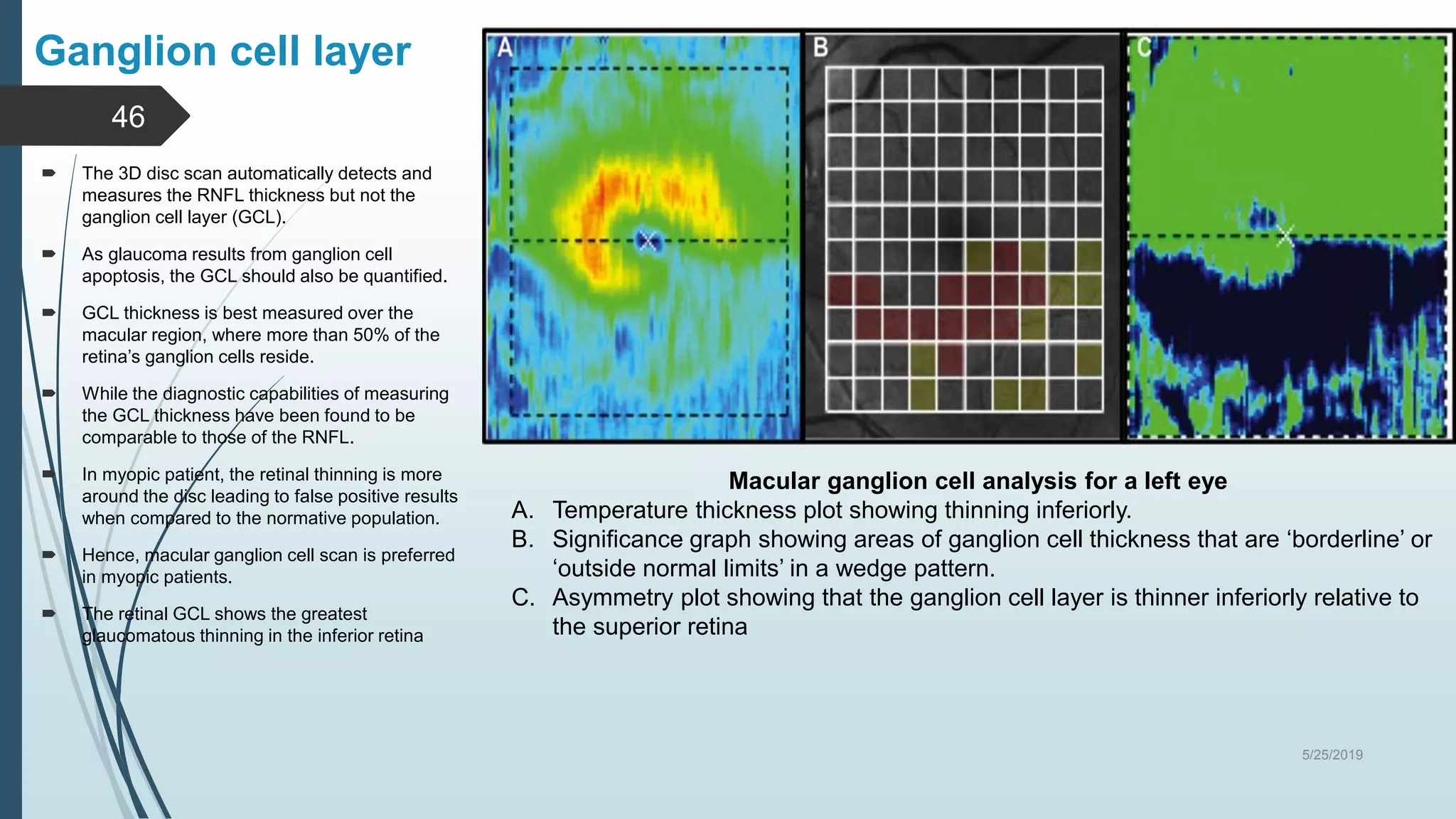Role of oct in ophthalmology | PPTX