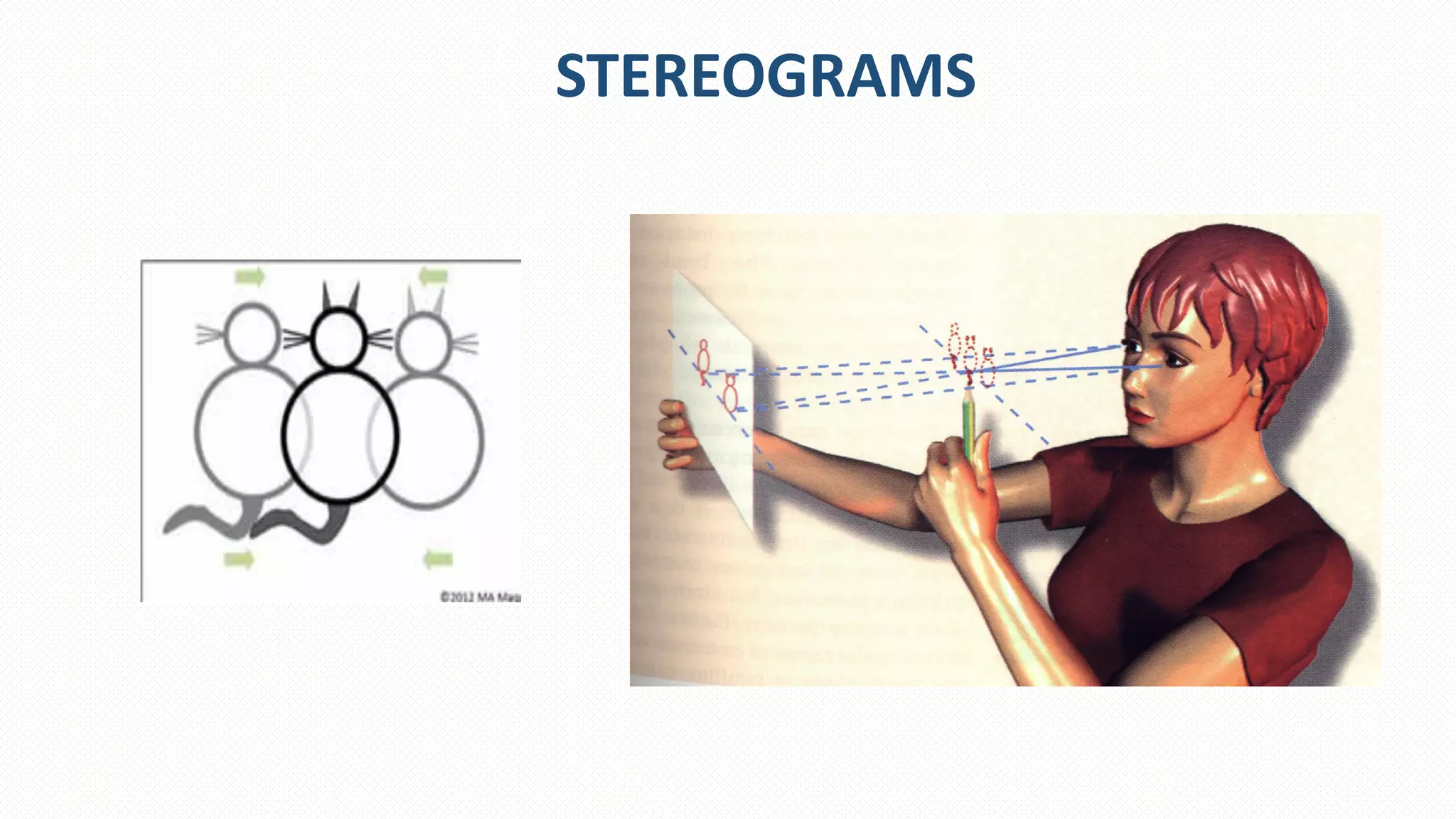 Role of orthoptics | PDF