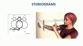 Role of orthoptics | PDF