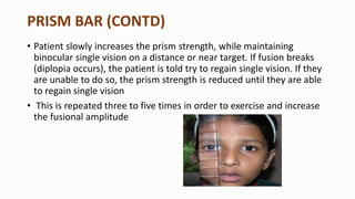 Role of orthoptics | PDF