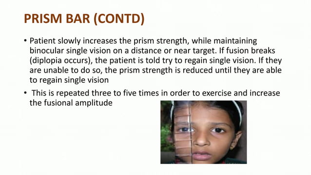 Role of orthoptics | PDF | Eye and Vision Conditions | Diseases and ...