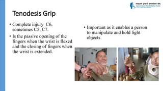 Role of Occupational Therapy (OT) | PPTX