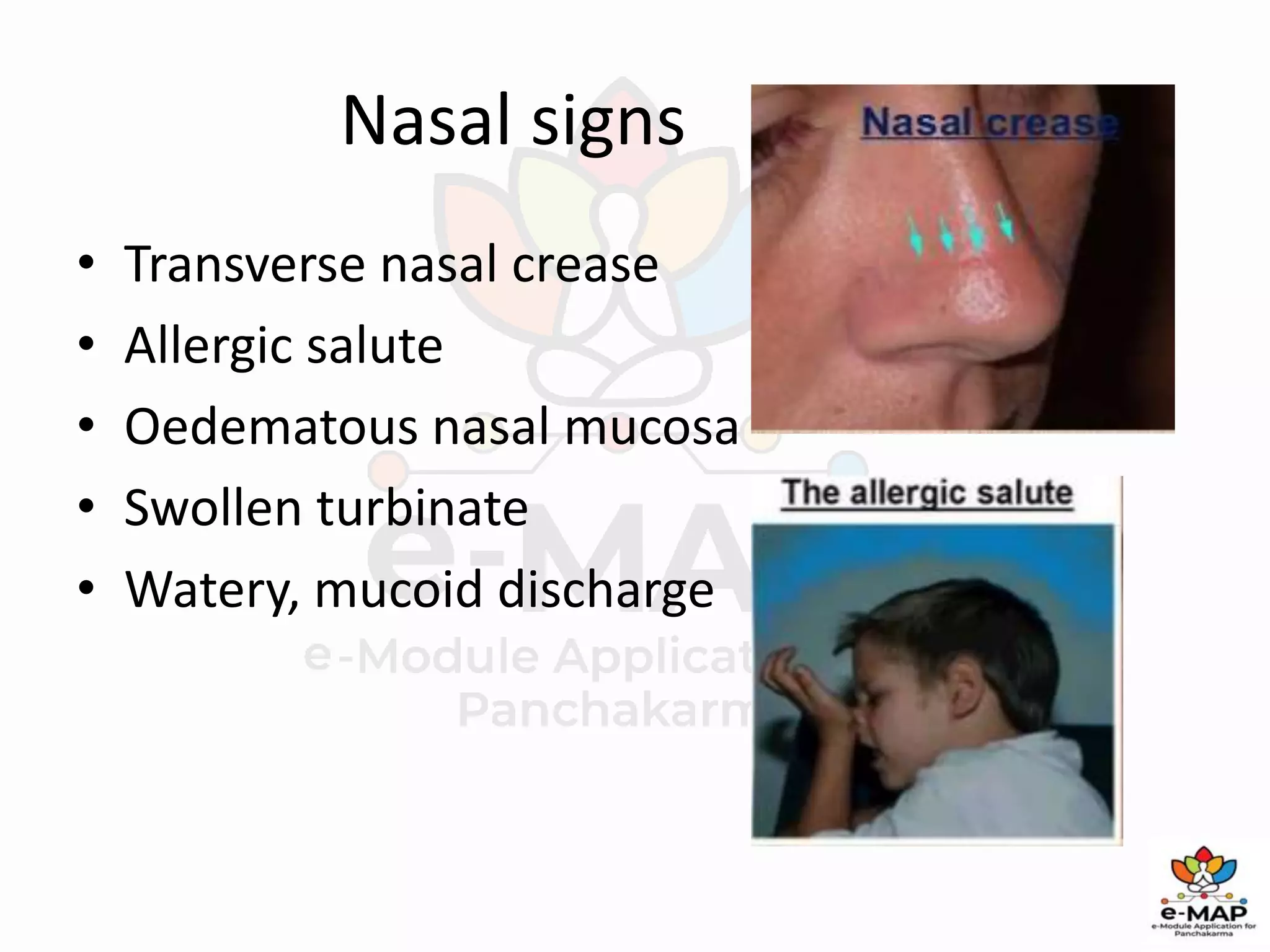 Role of Panchakarma in Allergic Rhinitis.pptx