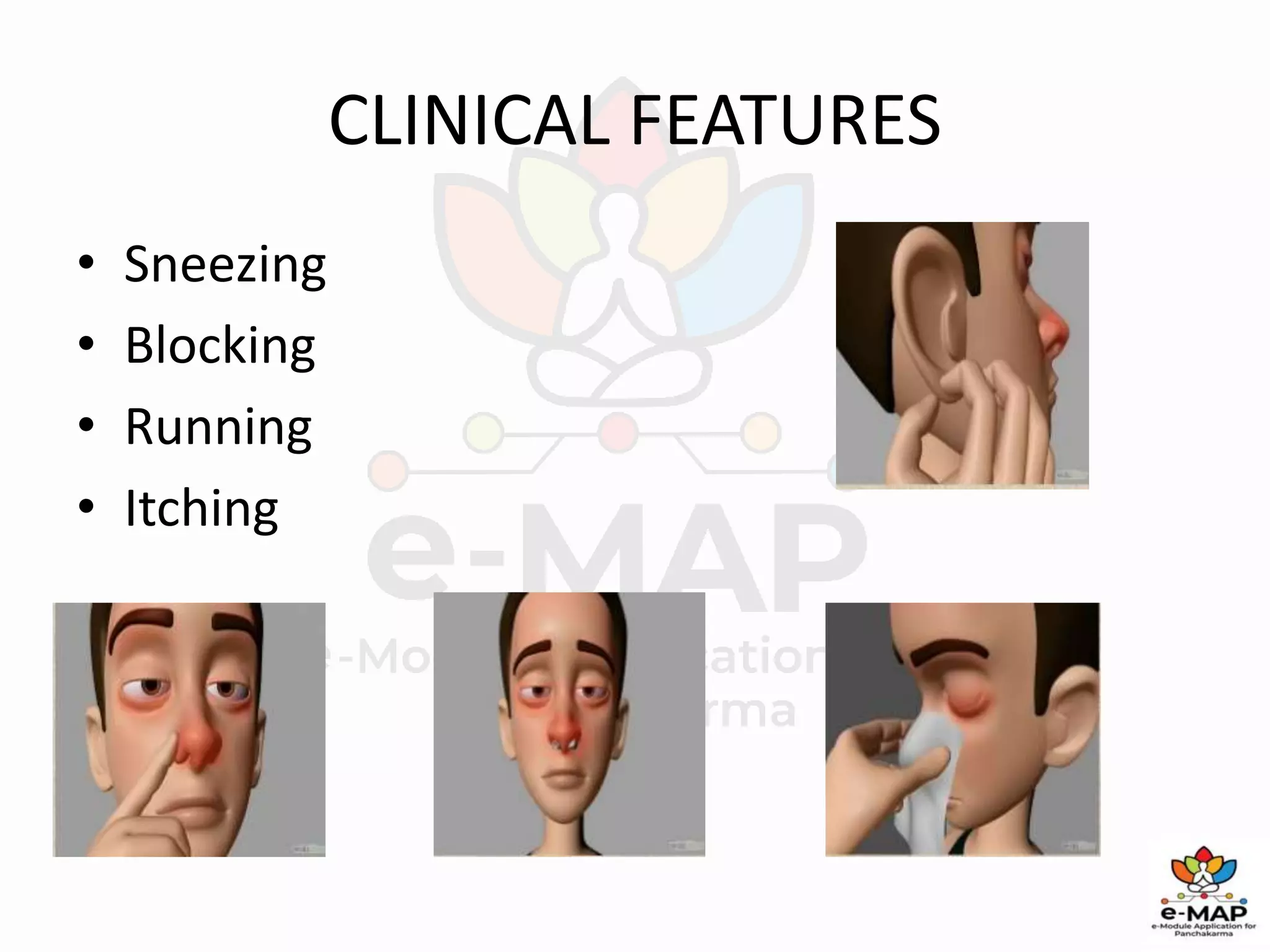 Role of Panchakarma in Allergic Rhinitis.pptx