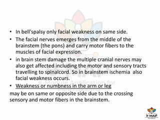 Role of Panchakarma in Bell's Palsy.pptx