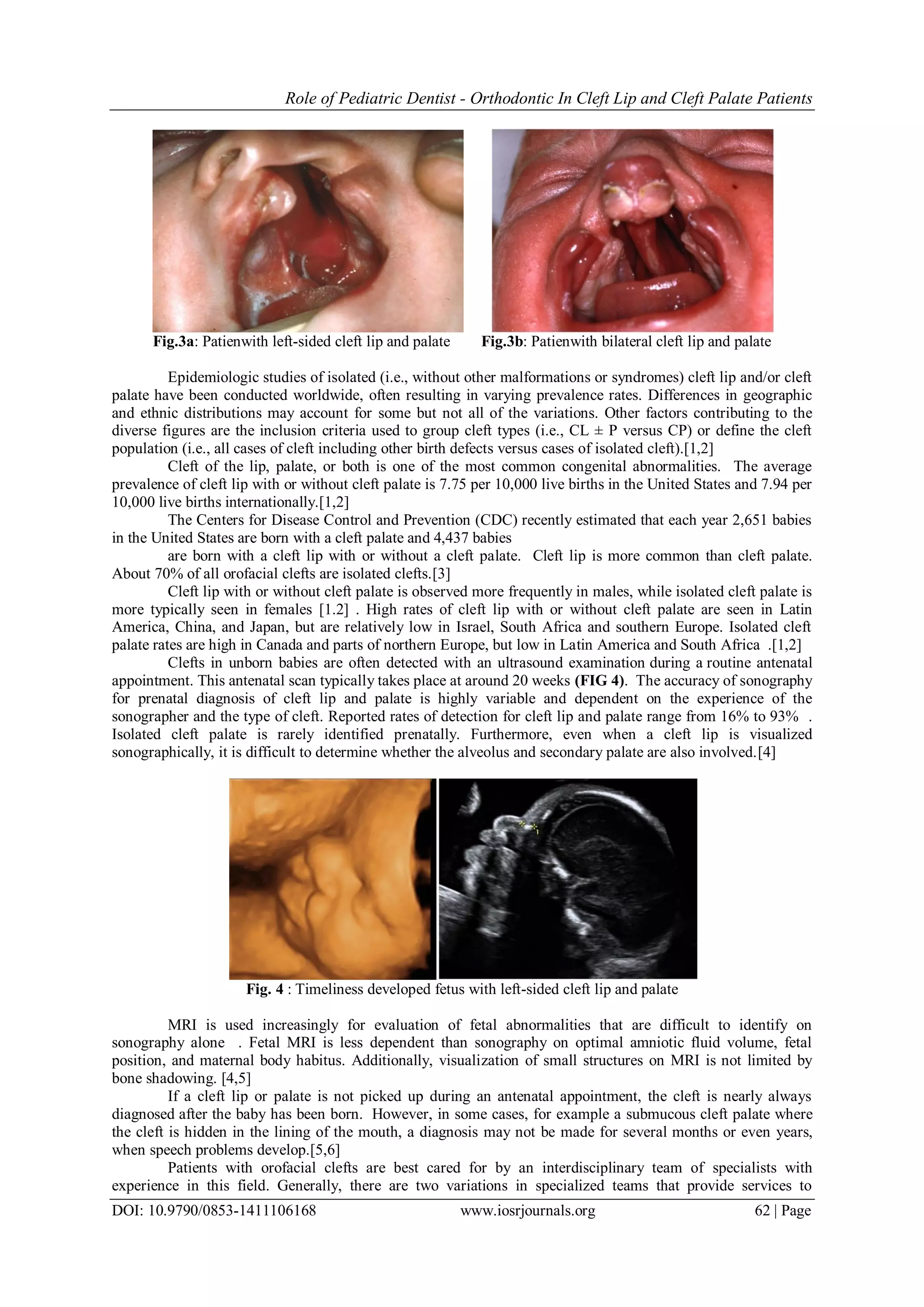 Role of pediatric dentist orthodontic in cleft lip and cleft palate ...