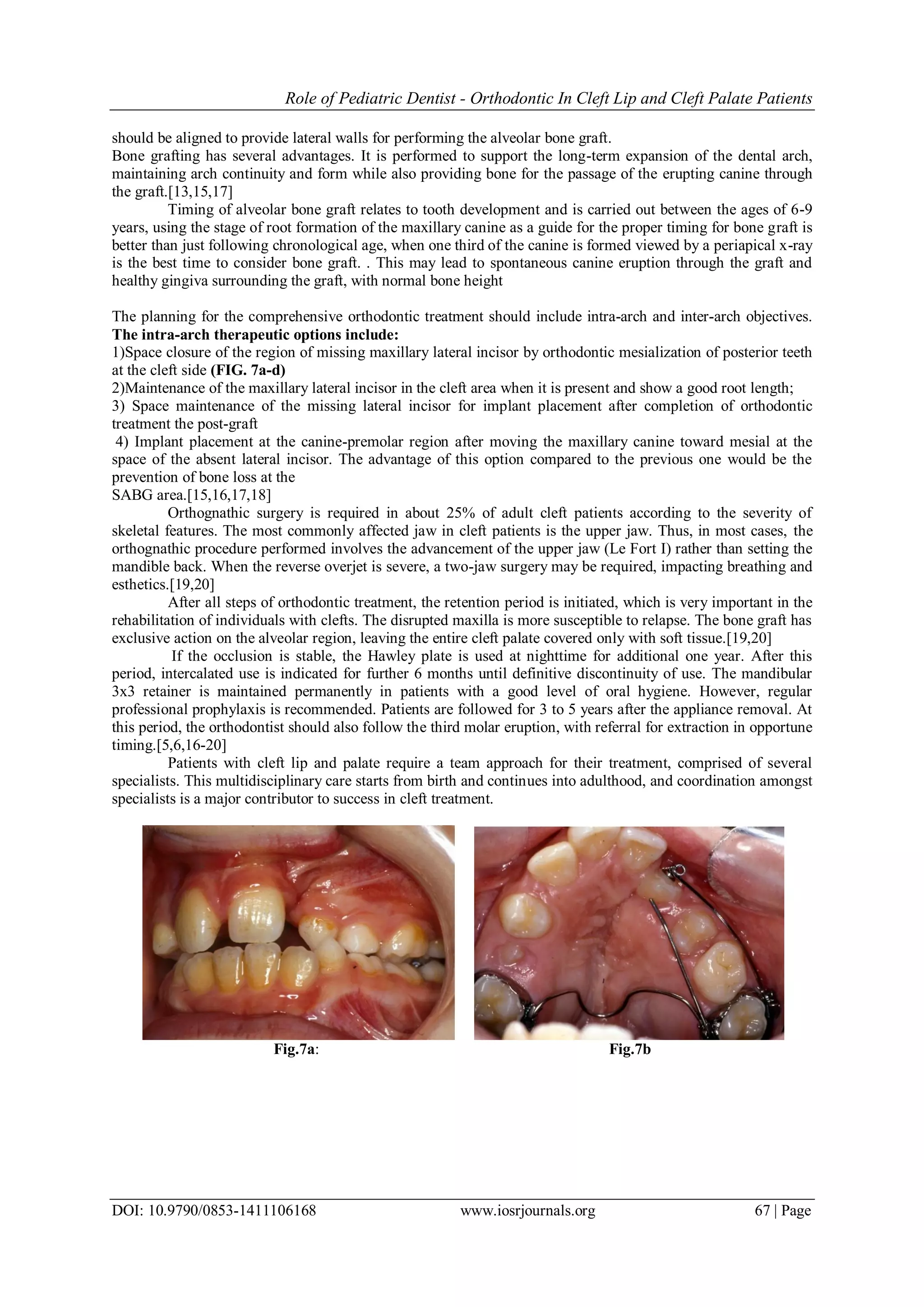 Role of pediatric dentist orthodontic in cleft lip and cleft palate ...