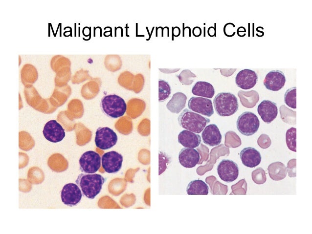 Role of peripheral blood