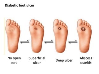 Role of phenytoin in diabetic foot alcer.pptx | Foot Health | Diseases ...