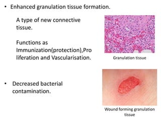 Role of phenytoin in diabetic foot alcer.pptx | Foot Health | Diseases ...