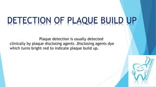 Role of plaque in etiology of dental caries | PPTX