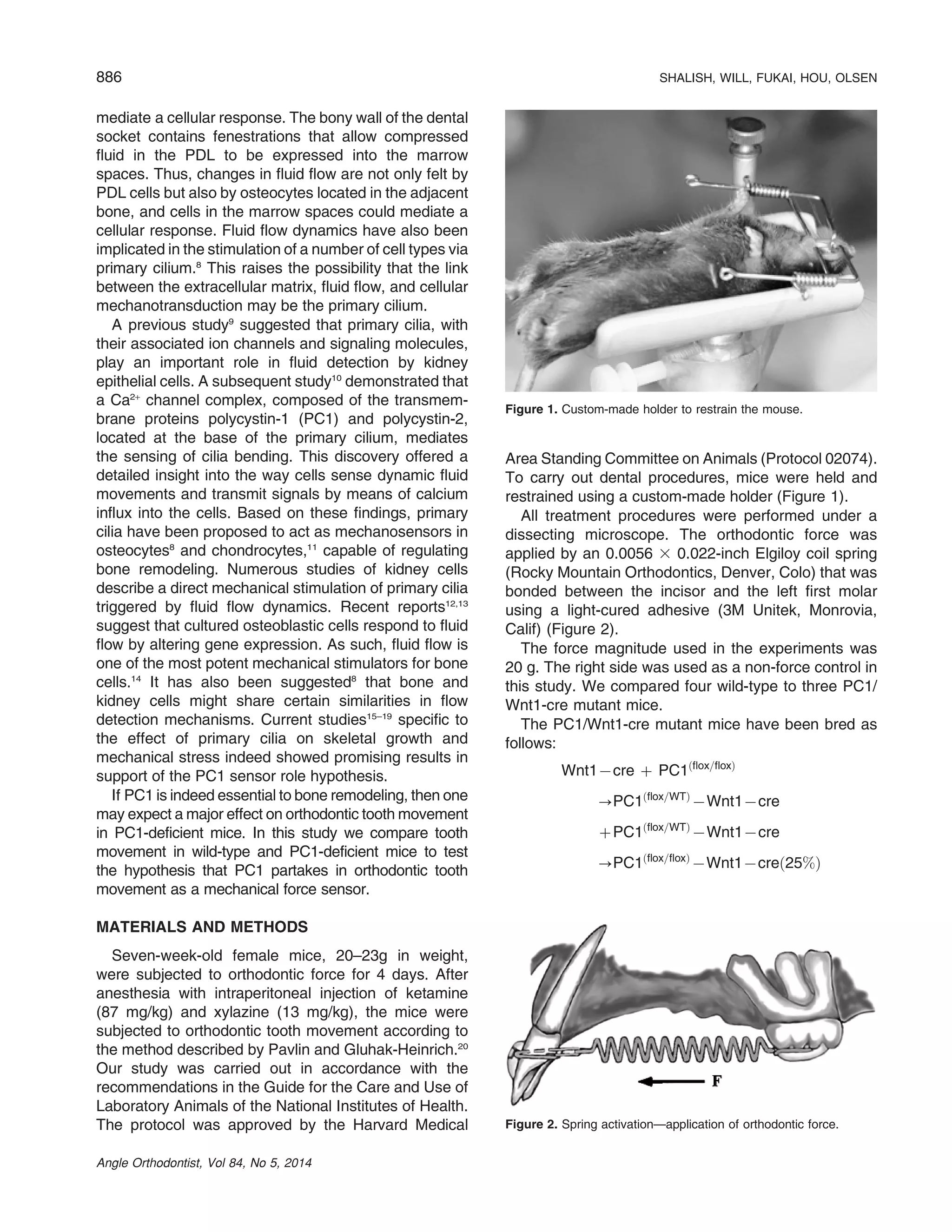 Role of polycystin 1 in bone remodeling- orthodontic tooth movement ...