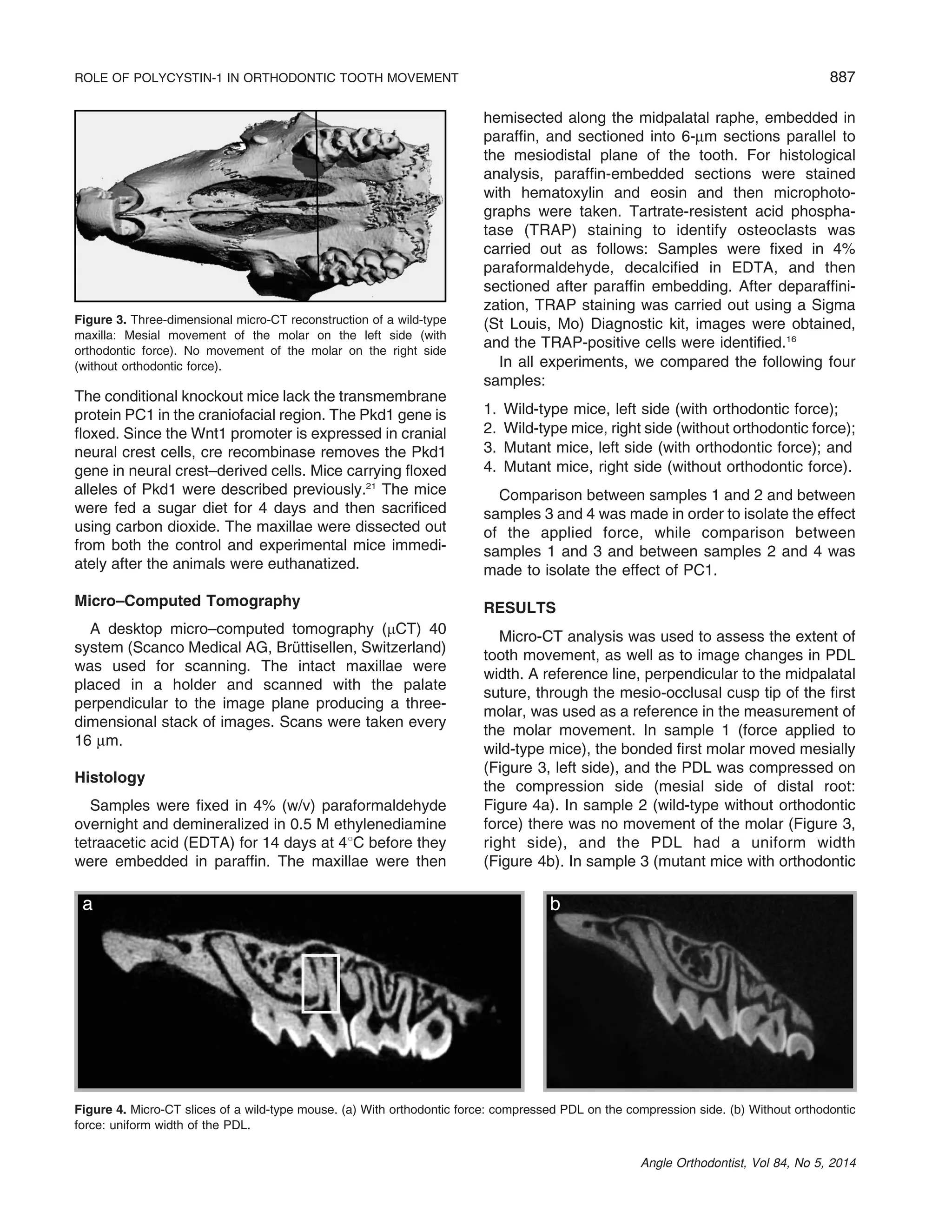 Role of polycystin 1 in bone remodeling- orthodontic tooth movement ...