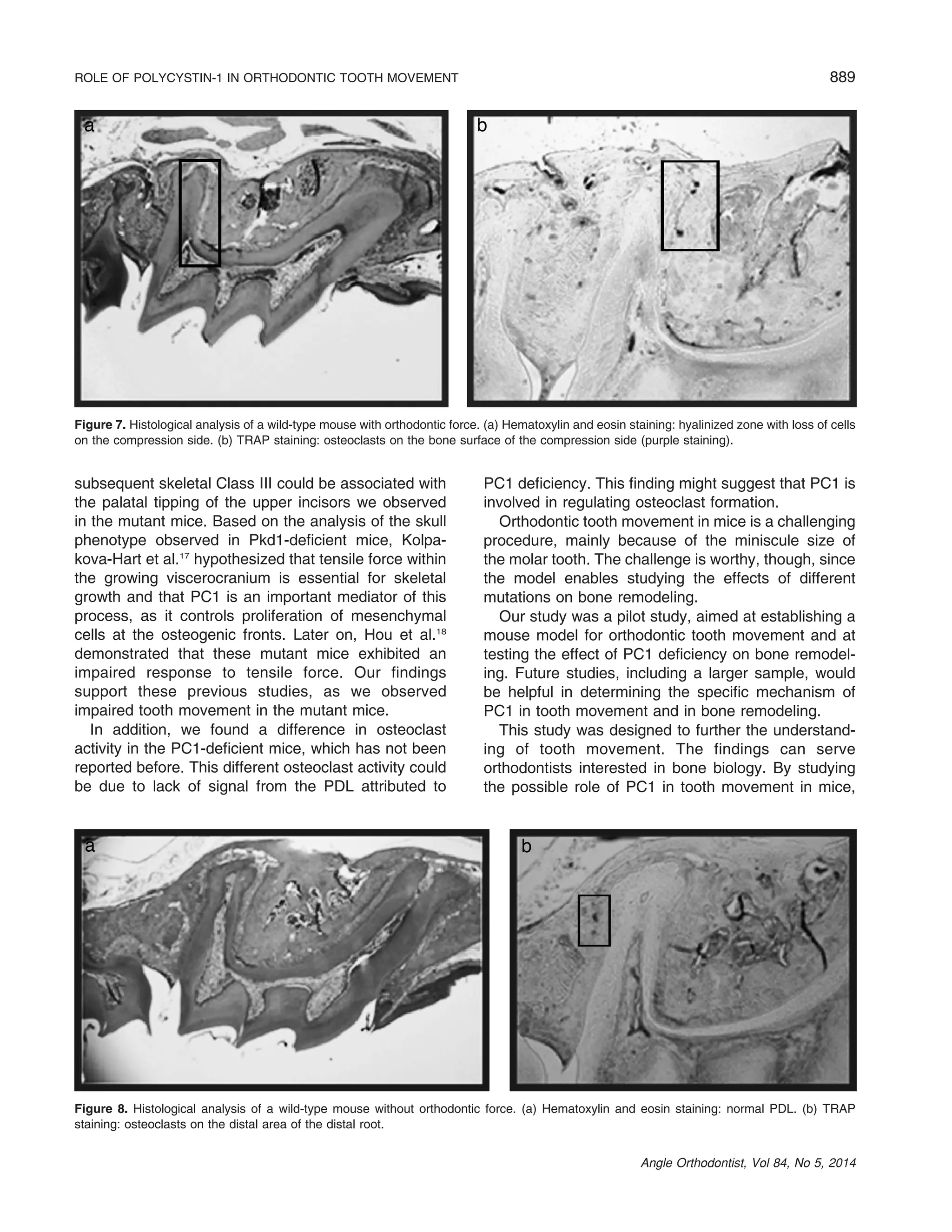 Role of polycystin 1 in bone remodeling- orthodontic tooth movement ...