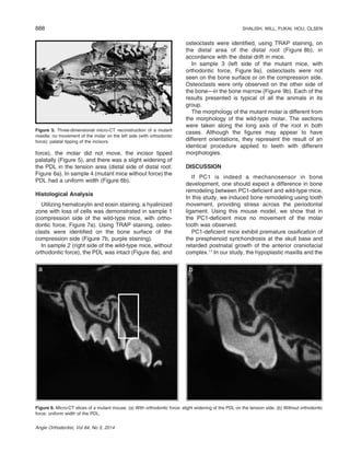 Role of polycystin 1 in bone remodeling- orthodontic tooth movement ...