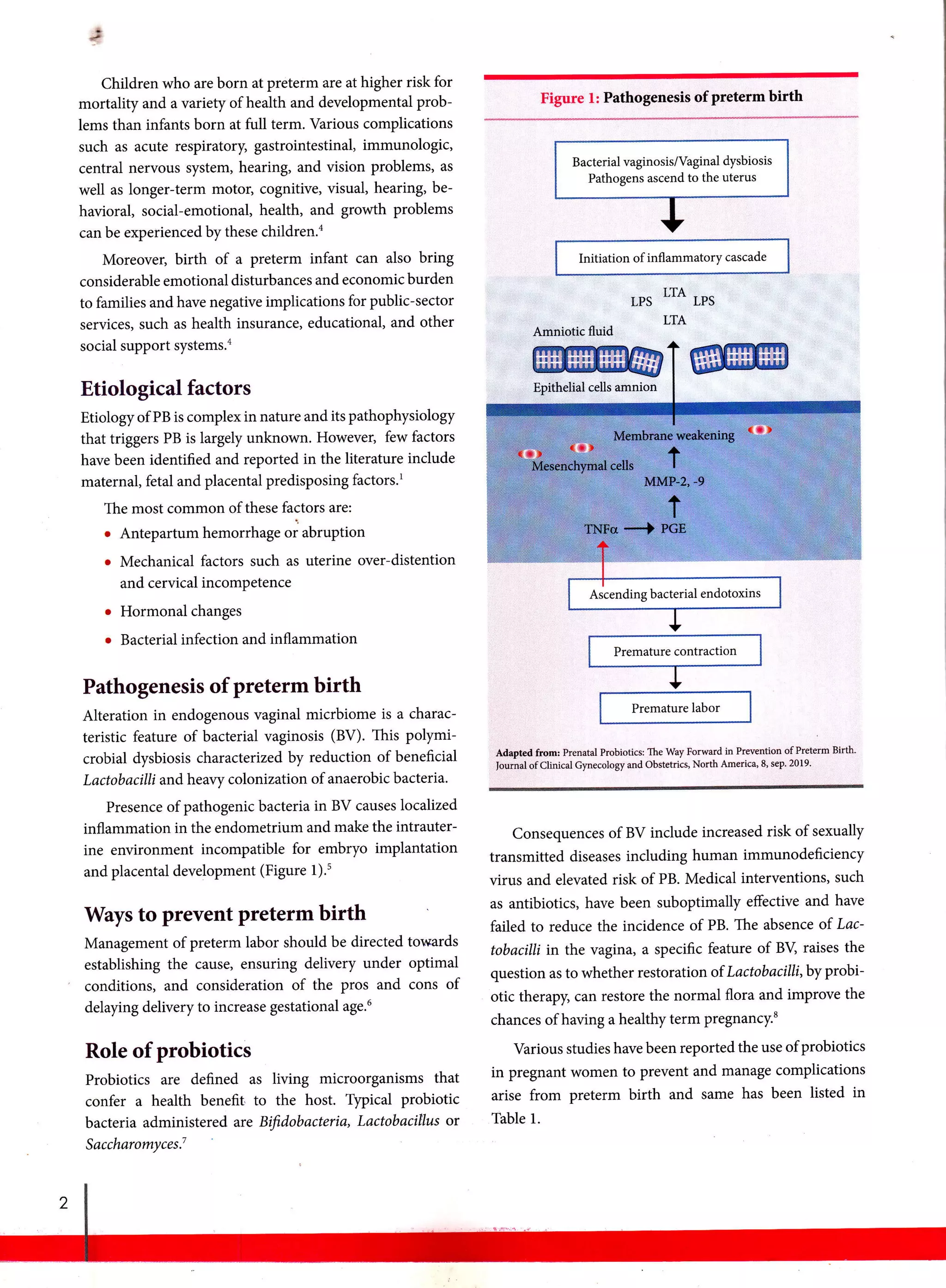 Role of prenatal probiotics in preterm birth | PDF