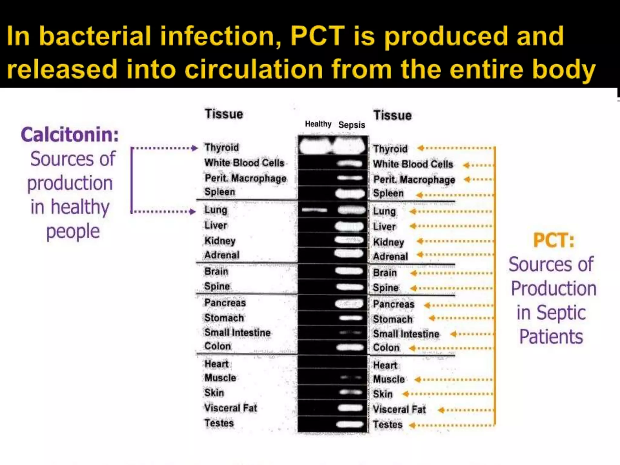 Role of procalcitonin in sepsis management | PPTX | Infectious Diseases ...