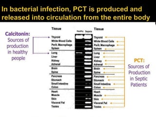 Role of procalcitonin in sepsis management | PPT