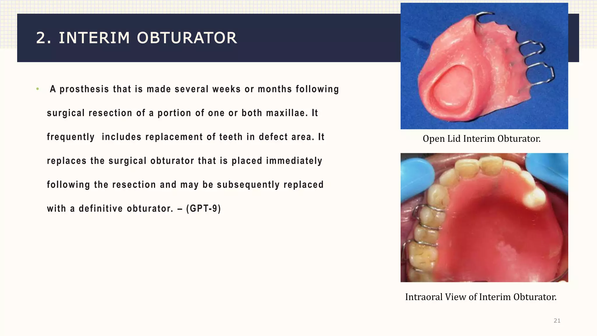 ROLE OF PROSTHODONTIC REHABILITATION AFTER SURGERY OF ORAL.pptx