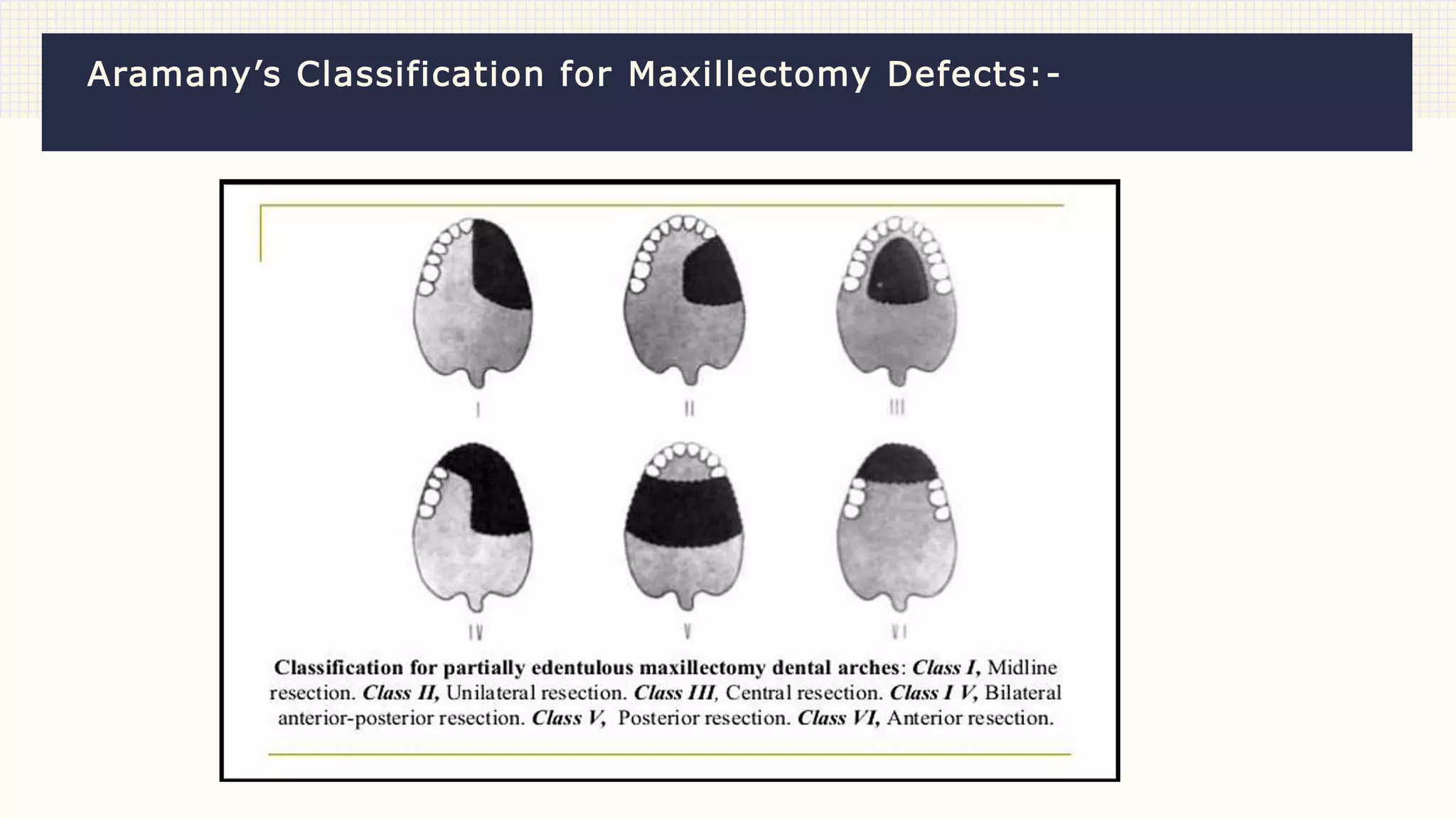 ROLE OF PROSTHODONTIC REHABILITATION AFTER SURGERY OF ORAL.pptx