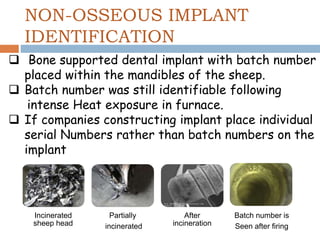 Role of prosthodontics in forensic dentistry | PPTX