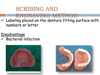 Role of prosthodontics in forensic dentistry | PPTX