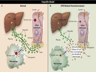 Role of protein in iron metabolism | PPT