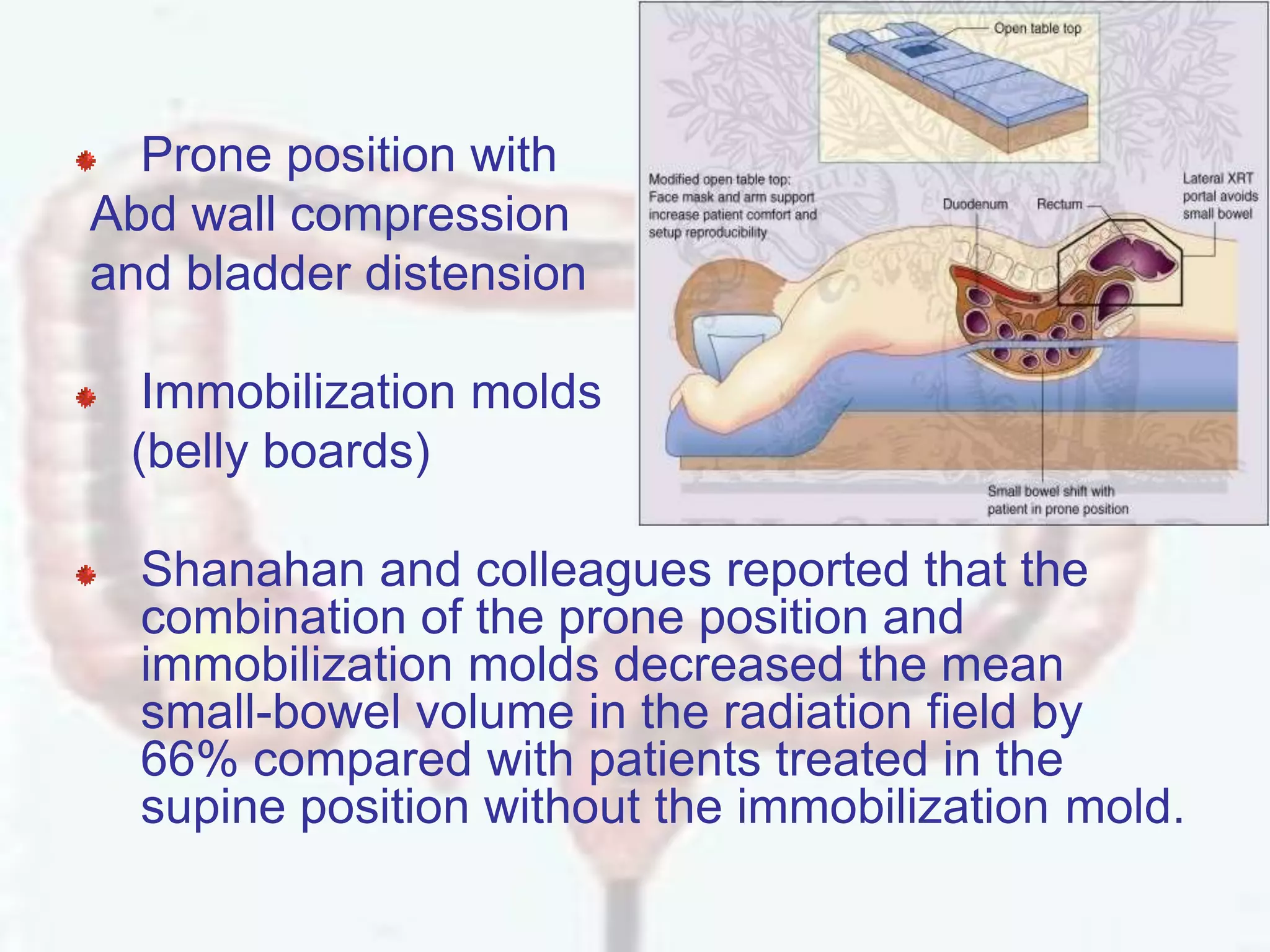 Role of radiation in carcinoma rectum and colon | PPTX