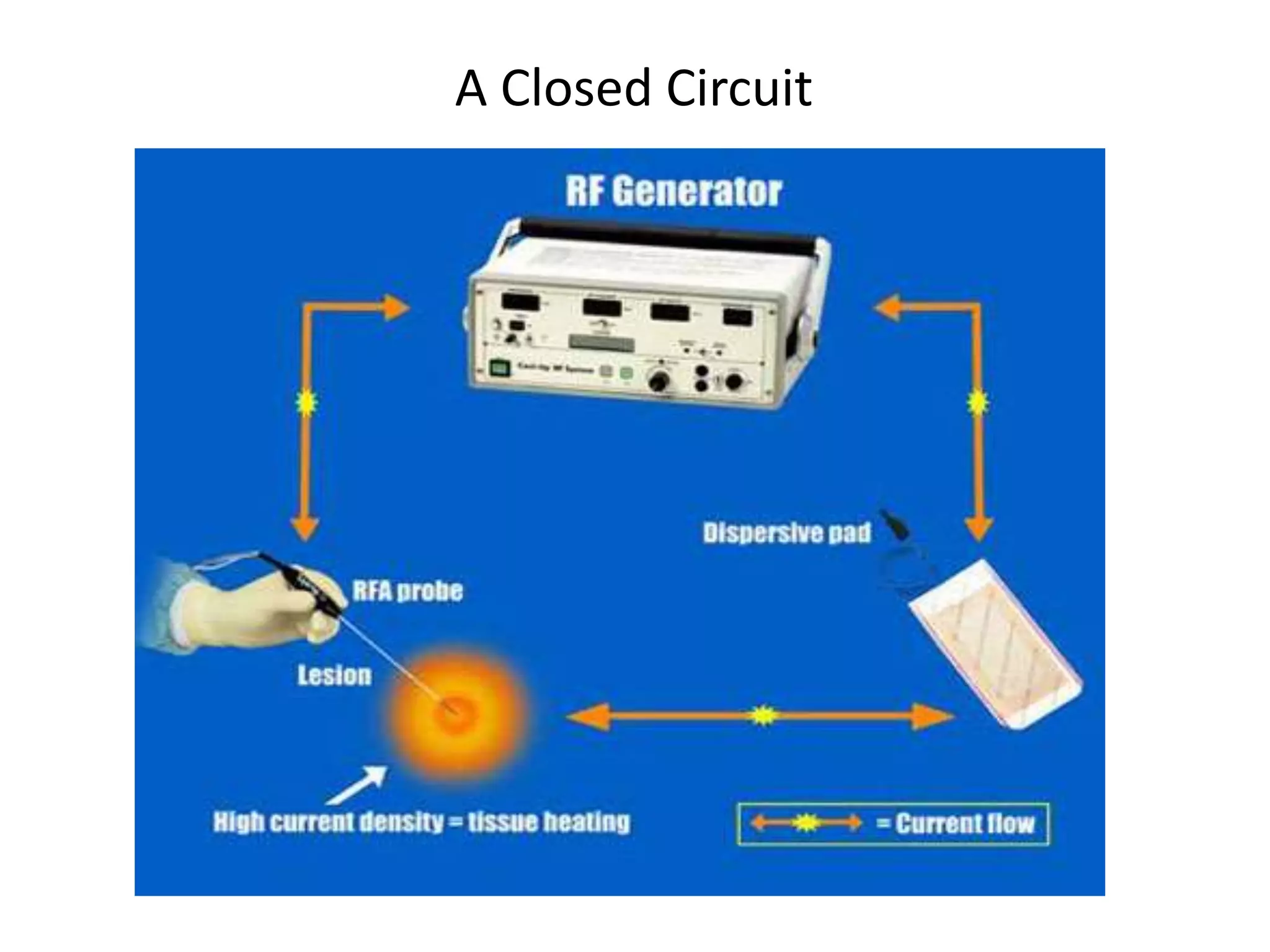 Role of radiofrequency ablation in pain management | PPTX