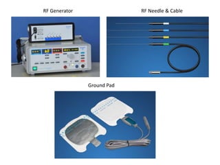 Role of radiofrequency ablation in pain management | PPTX