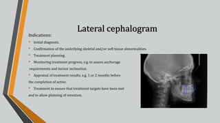 Role of radiology in orthodontics | PPTX