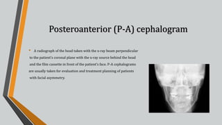 Role of radiology in orthodontics | PPTX