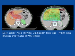 Role of chemotherapy and radiotherapy in Ca gall bladder | PPTX
