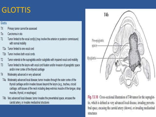 ROLE OF RADIOTHERAPY AND CHEMOTHERAPY IN CARCINOMA LARYNX1 (1).pptx
