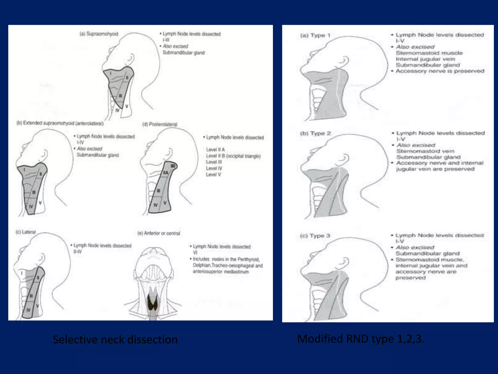 Role of radiotherapy and chemotherapy in oral cavity cancer | PPTX