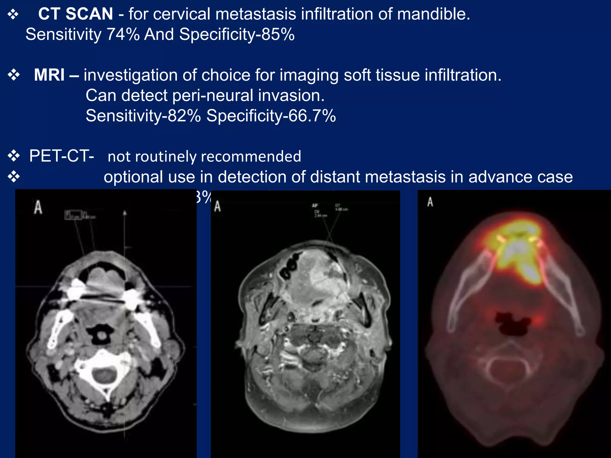 Role of radiotherapy and chemotherapy in oral cavity cancer | PPTX