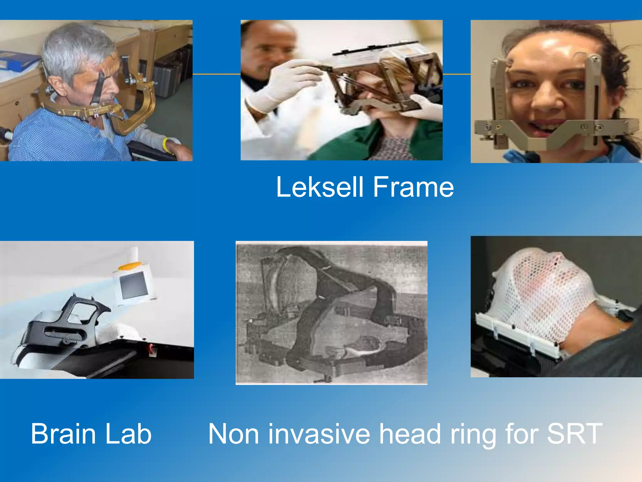 Role of radiotherapy in brain tumours | PPTX