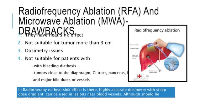 Role of Radiotherapy in Primary and Metastatic Liver Tumors | PPTX