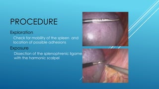 Role of spleenectomy in itp | PPTX